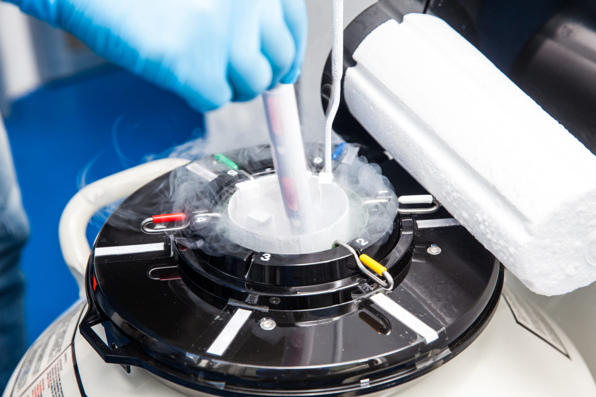 Sperm Thawing Procedure | Fairfax Cryobank Sperm Bank