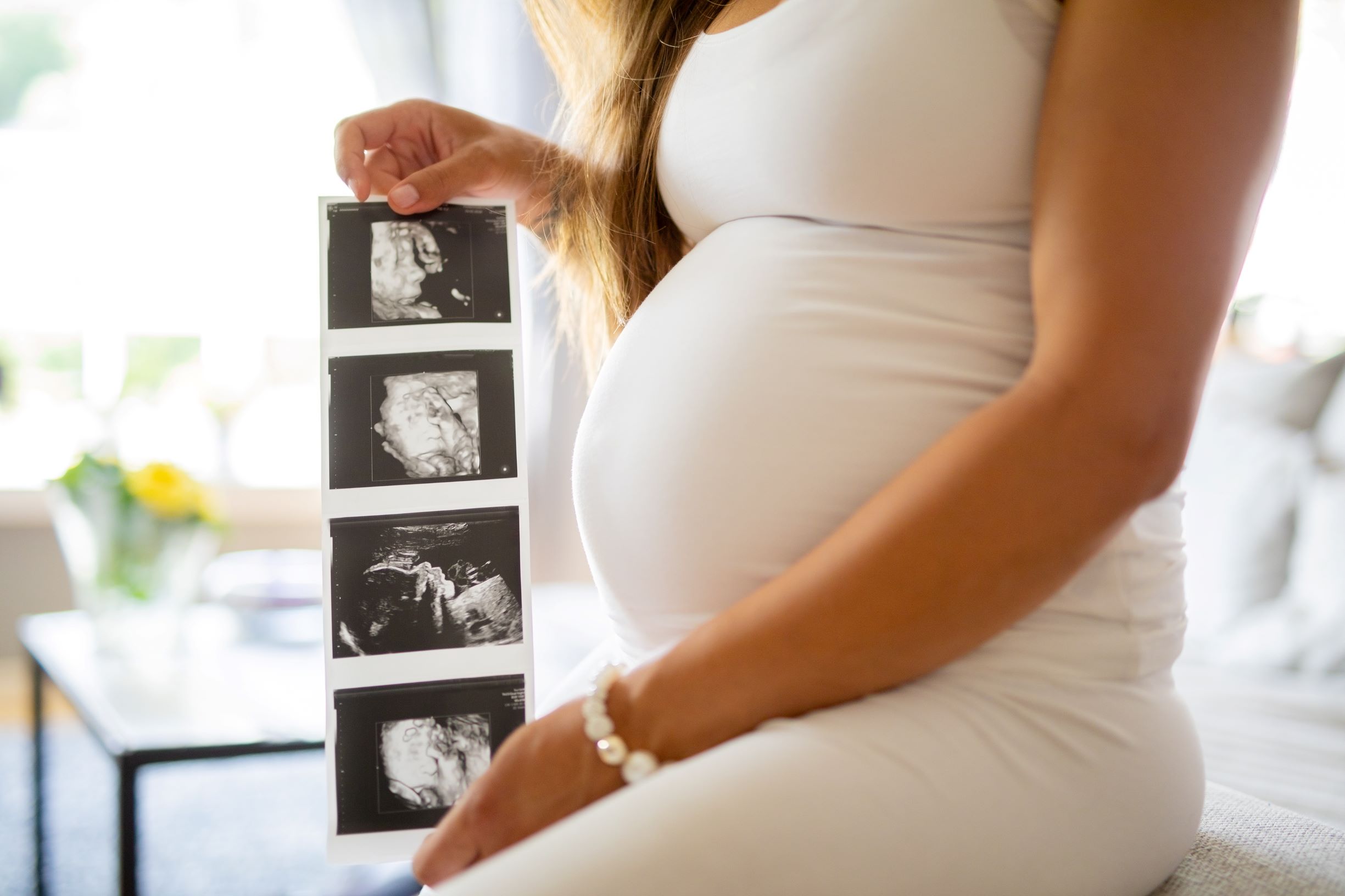 Pregnancy Pledge® | Fairfax Cryobank